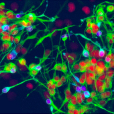 The BRAIN Initiative