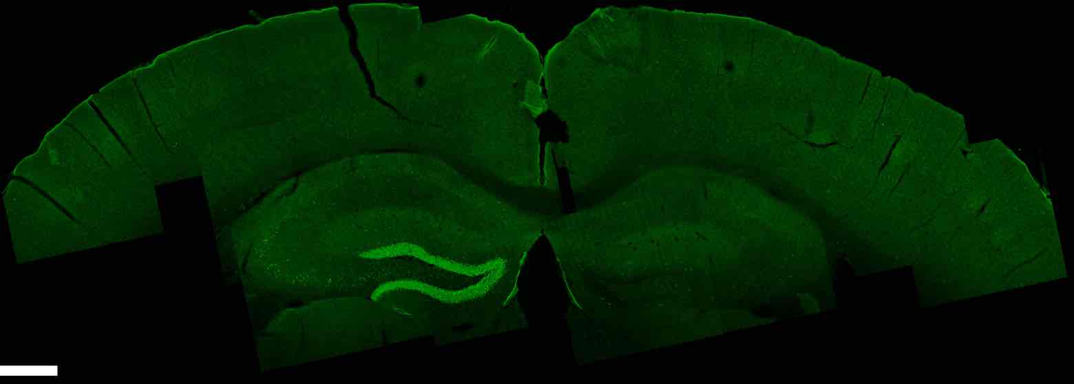 Researchers develop non-invasive deep brain stimulation method - The ... Researchers develop non-invasive deep brain stimulation method - The ...