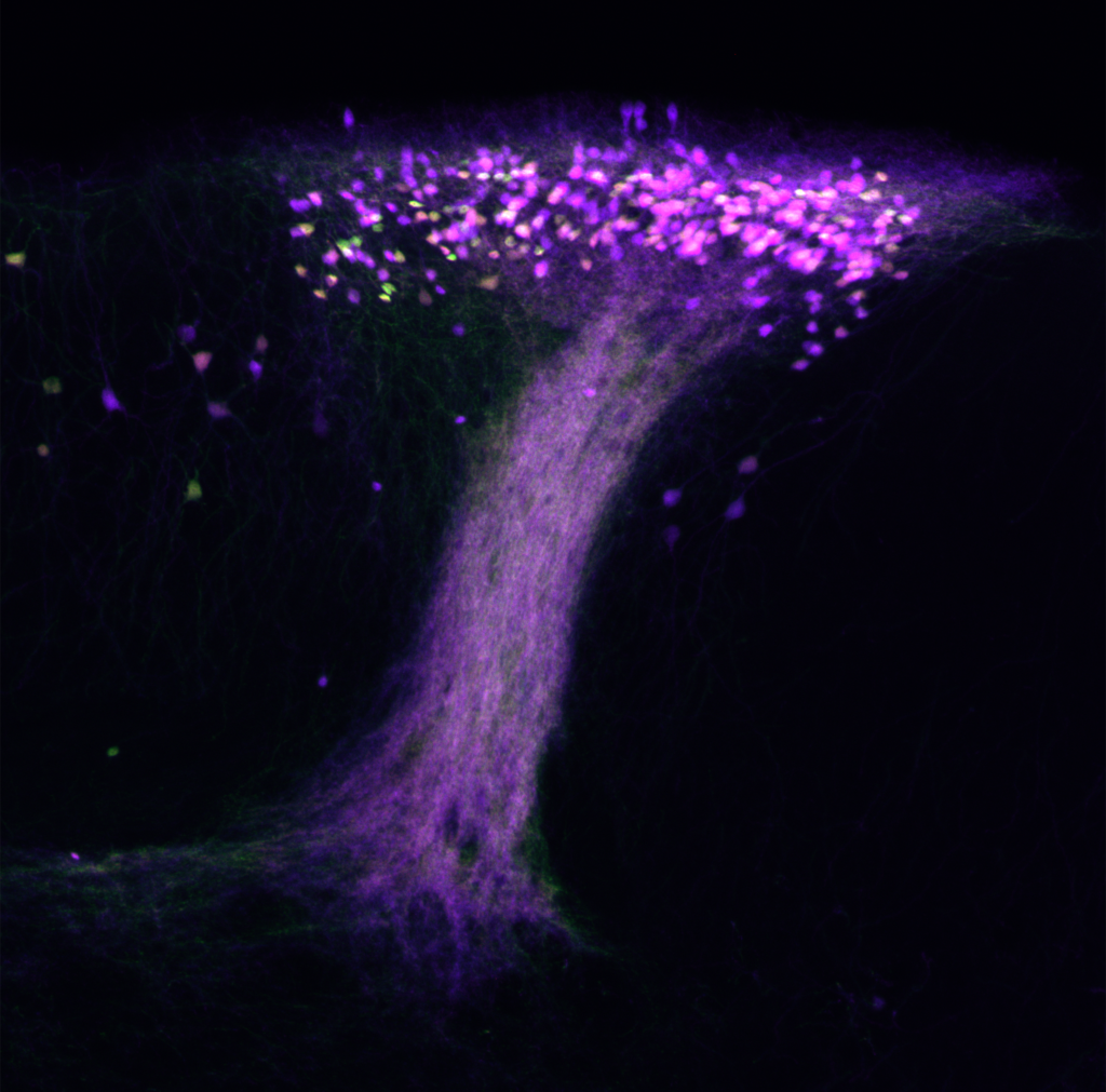 The Art of the BRAIN: Snapshots from the 2024 Contest - The BRAIN ...